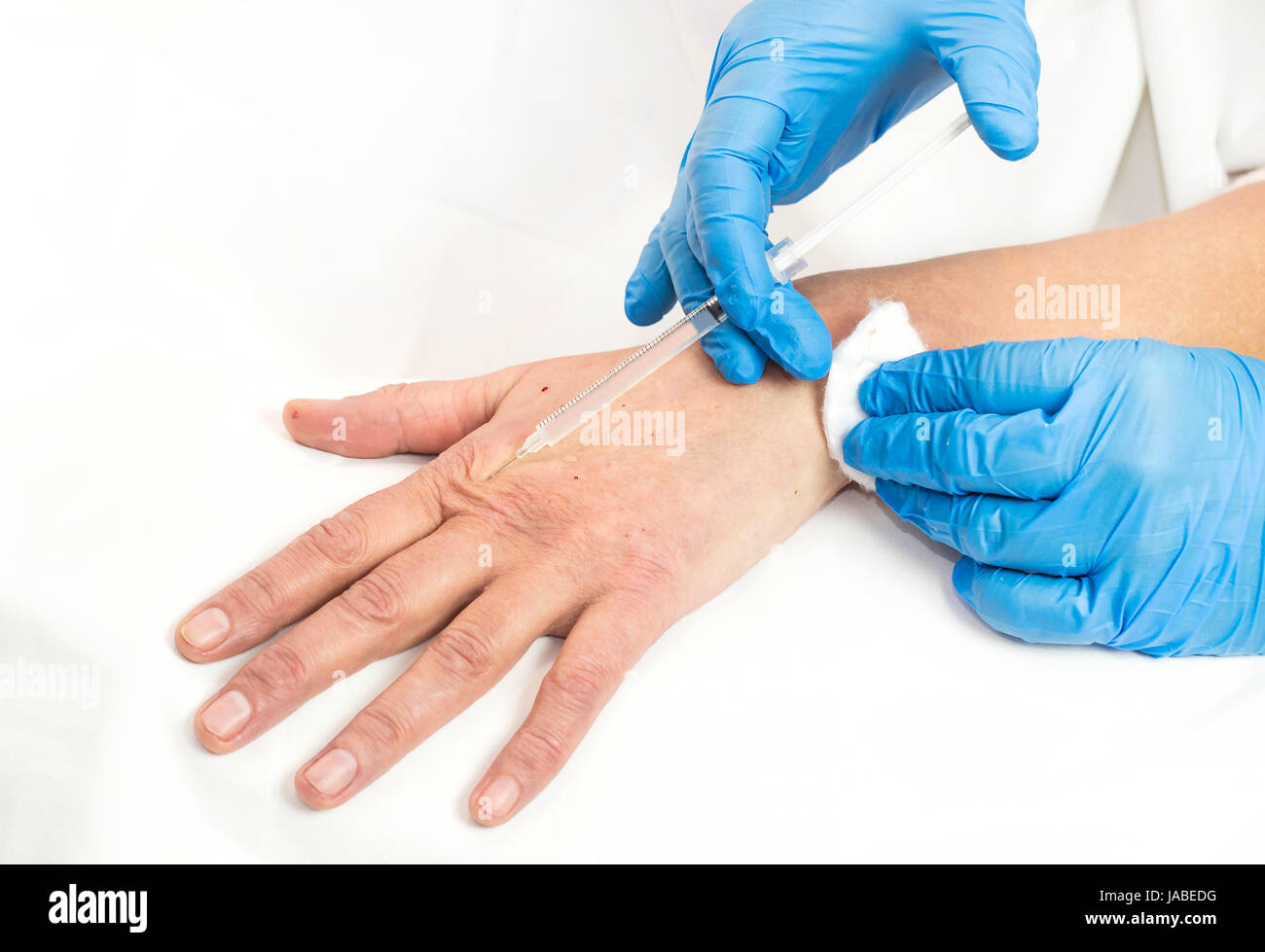 Mesotherapy process on a female hand in clinic Stock Photo - Alamy