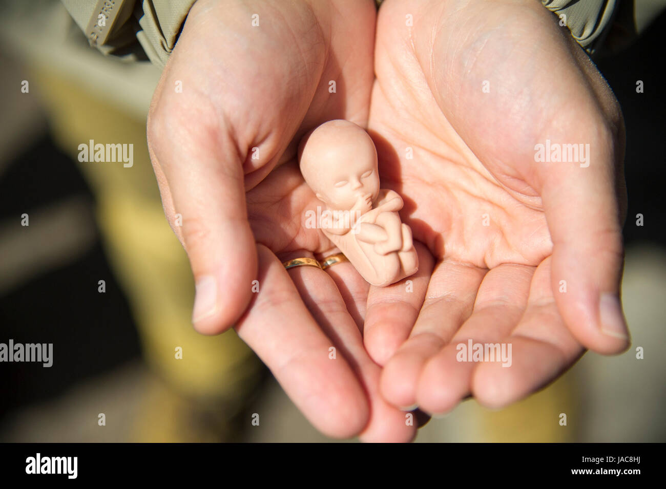 Fetal foetal hi-res stock photography and images - Alamy