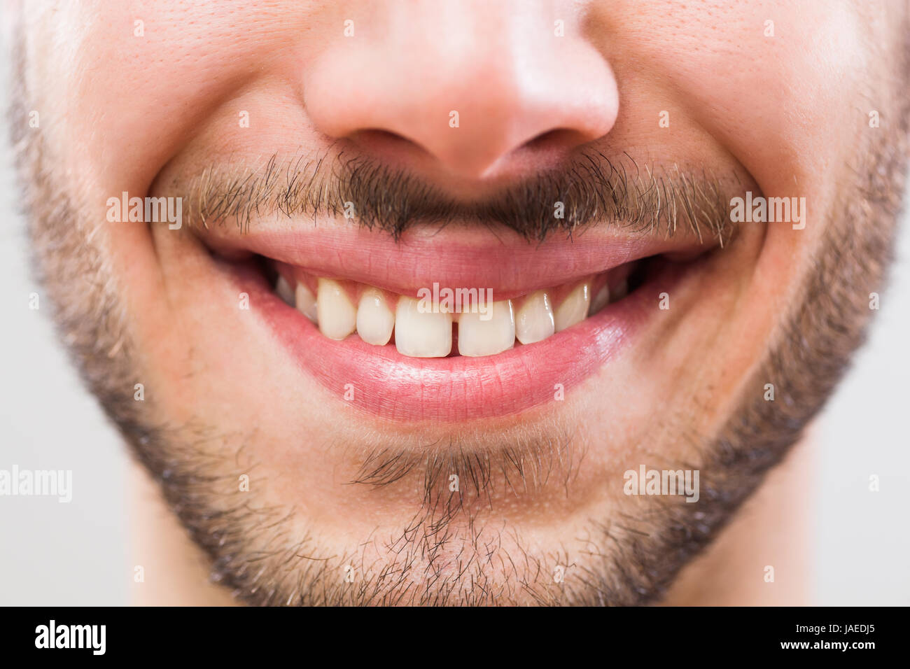 Perfect Male Teeth