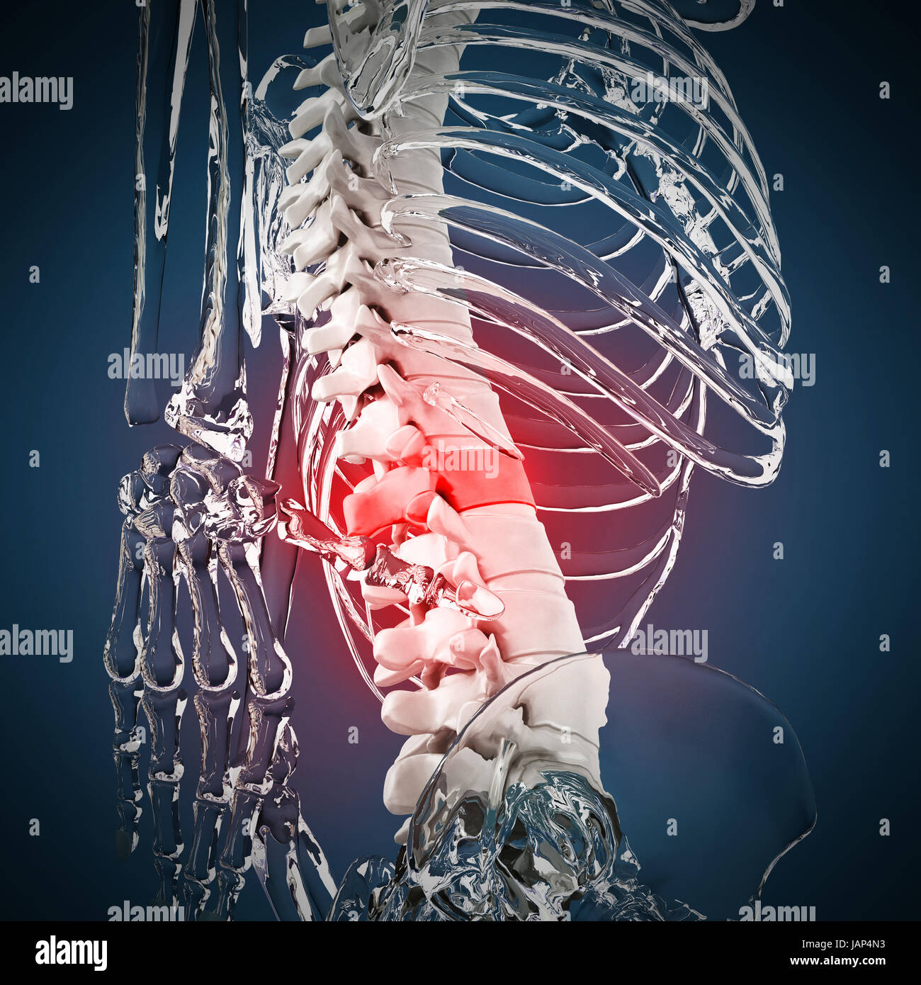 Lower Back Pain Illustration Stock Photos & Lower Back Pain ...