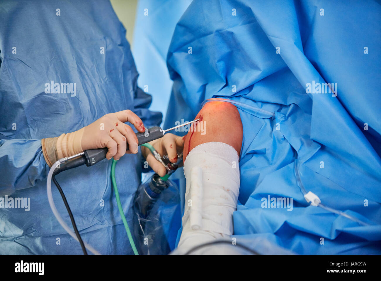 team of surgeons and nurses performing laparoscopic minimally invasive ...