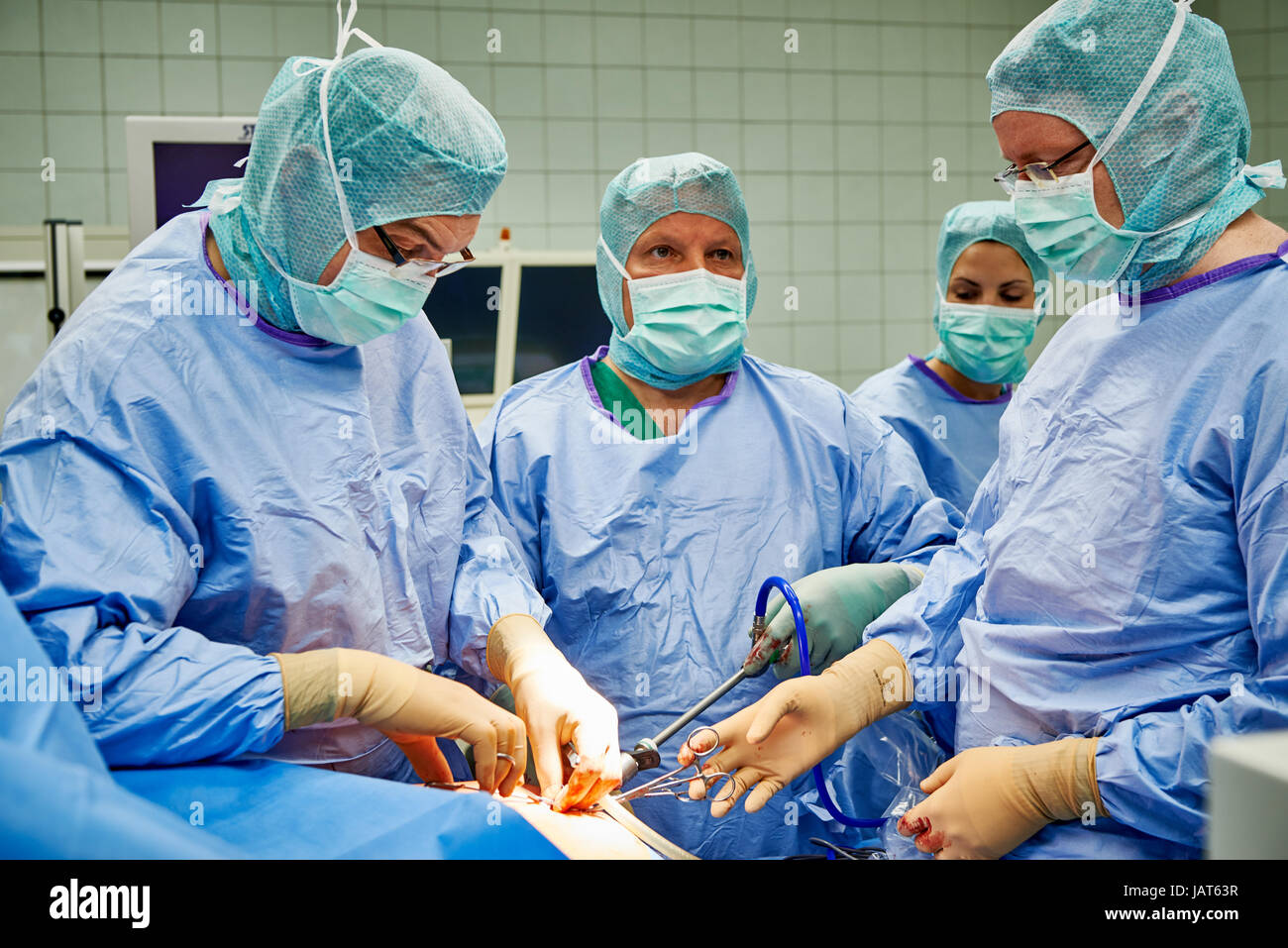 team of surgeons and nurses performing laparoscopic minimally invasive ...