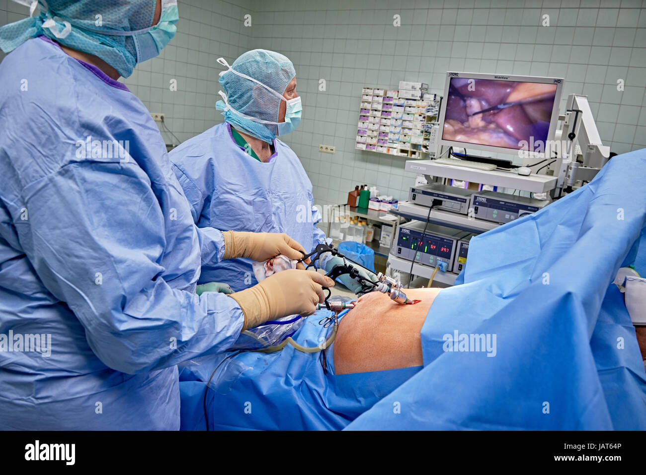 team of surgeons and nurses performing laparoscopic minimally invasive ...