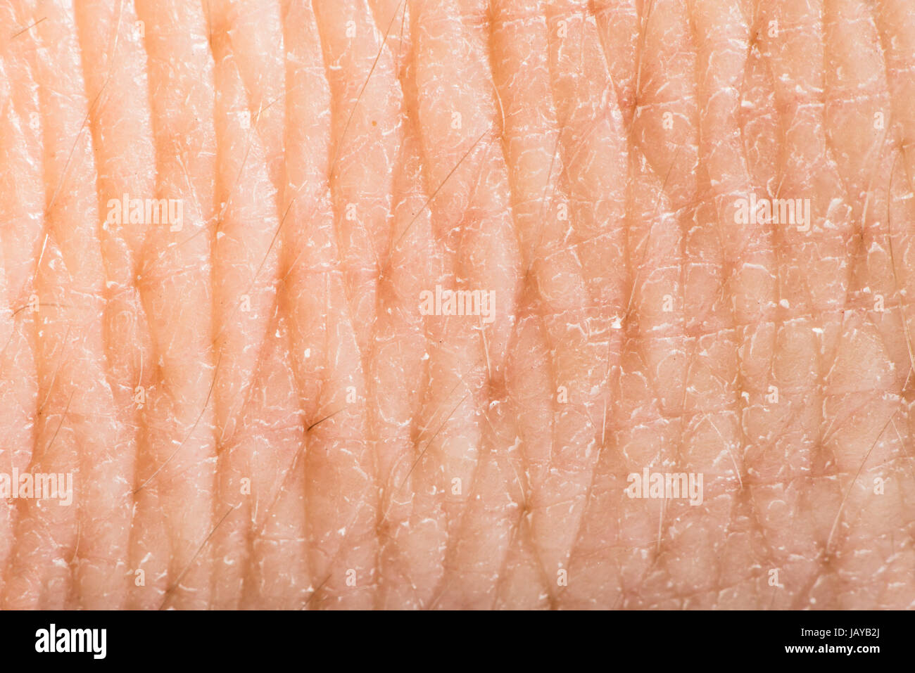 Human epidermis cells hi-res stock photography and images - Alamy