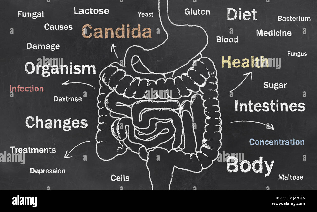 Words of Intestine Condition sketched on a Blackboard Stock Photo - Alamy