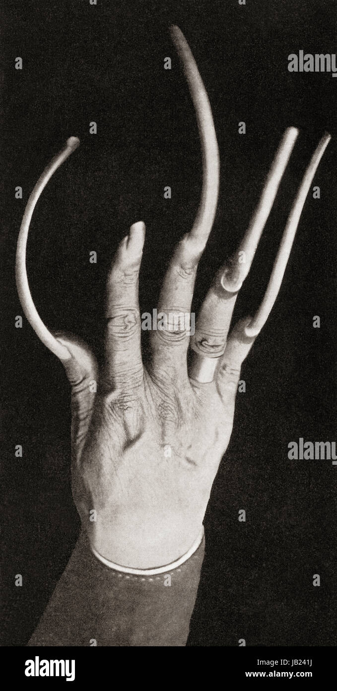 Annamite hi-res stock photography and images - Alamy