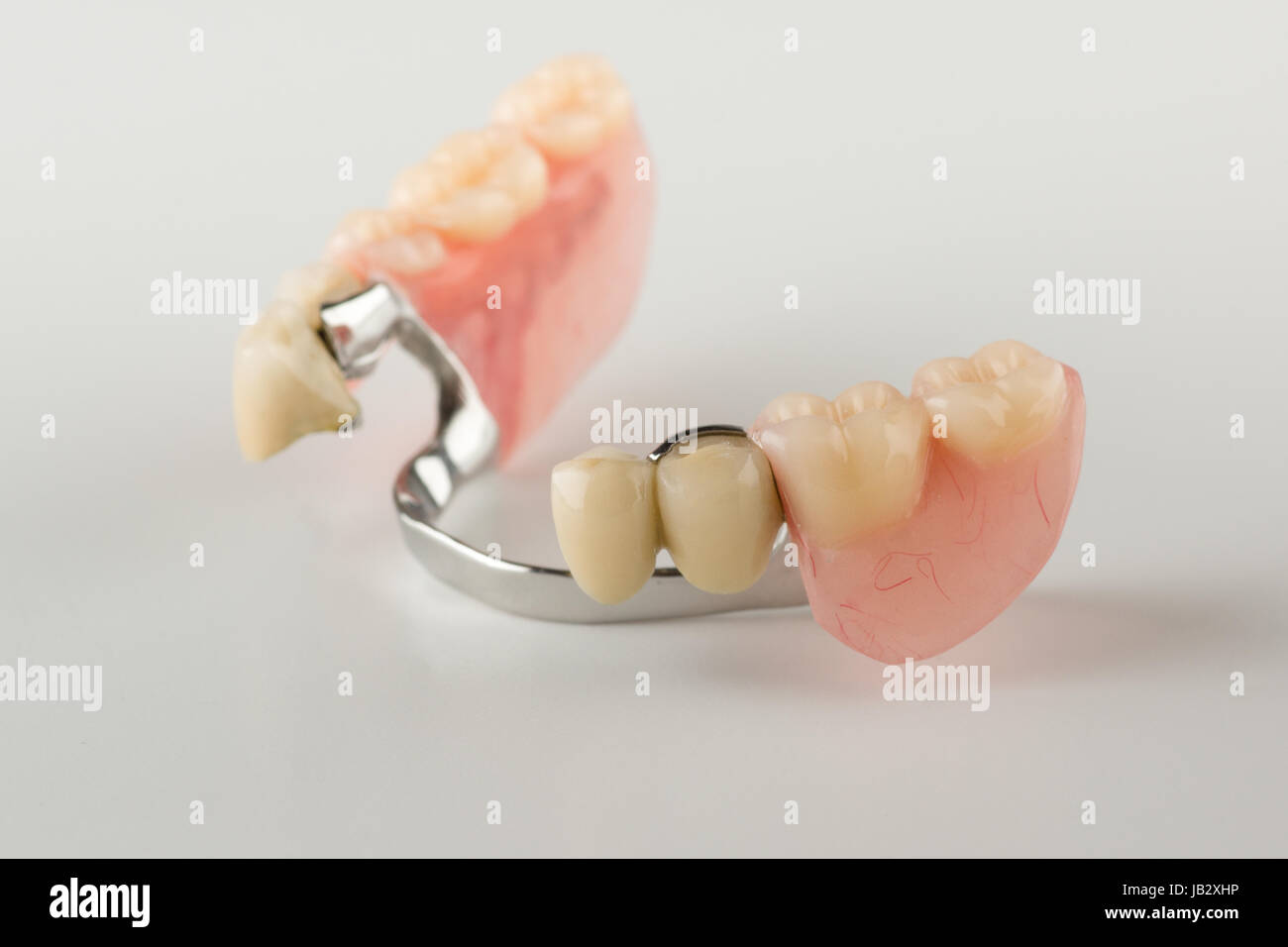 Clasp prosthesis with lock fixation on a white background Stock Photo ...