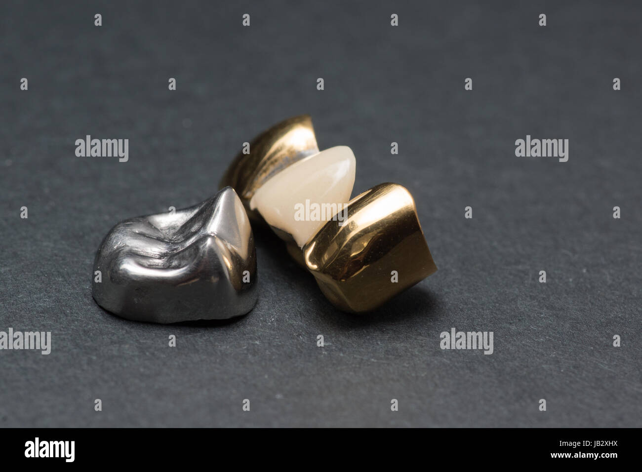 Steel artificial dental crown for dentition restoration Stock Photo - Alamy