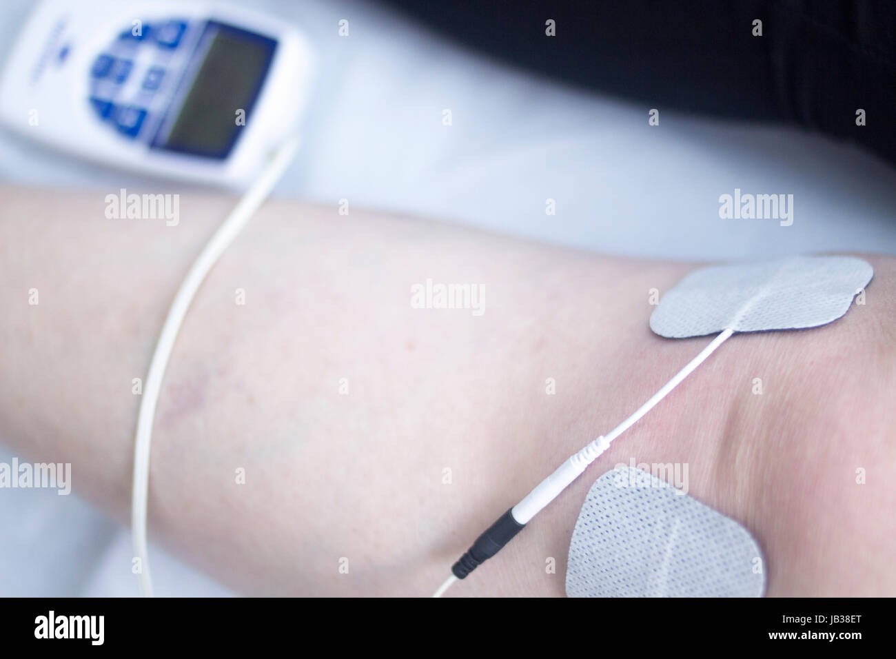Physical therapy mecical clinic physiotherapy electrical impulse shock ...