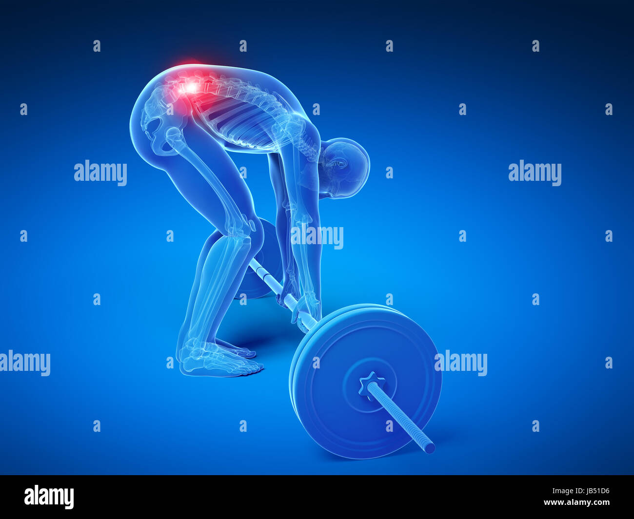 3d rendered medical illustration - wrong lifting posture Stock Photo ...