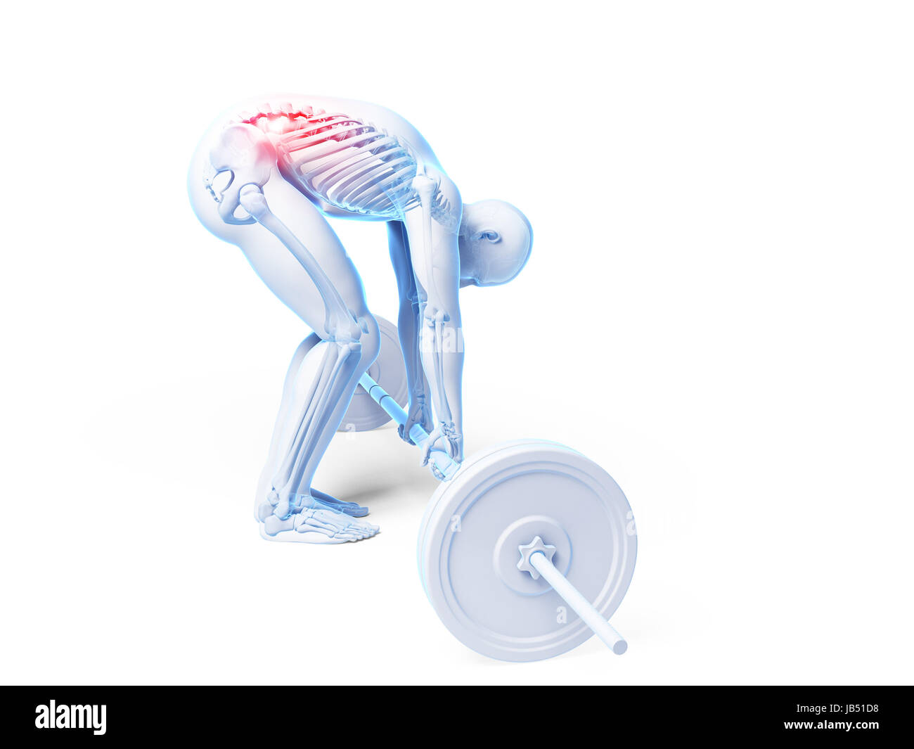 3d rendered medical illustration - wrong lifting posture Stock Photo ...