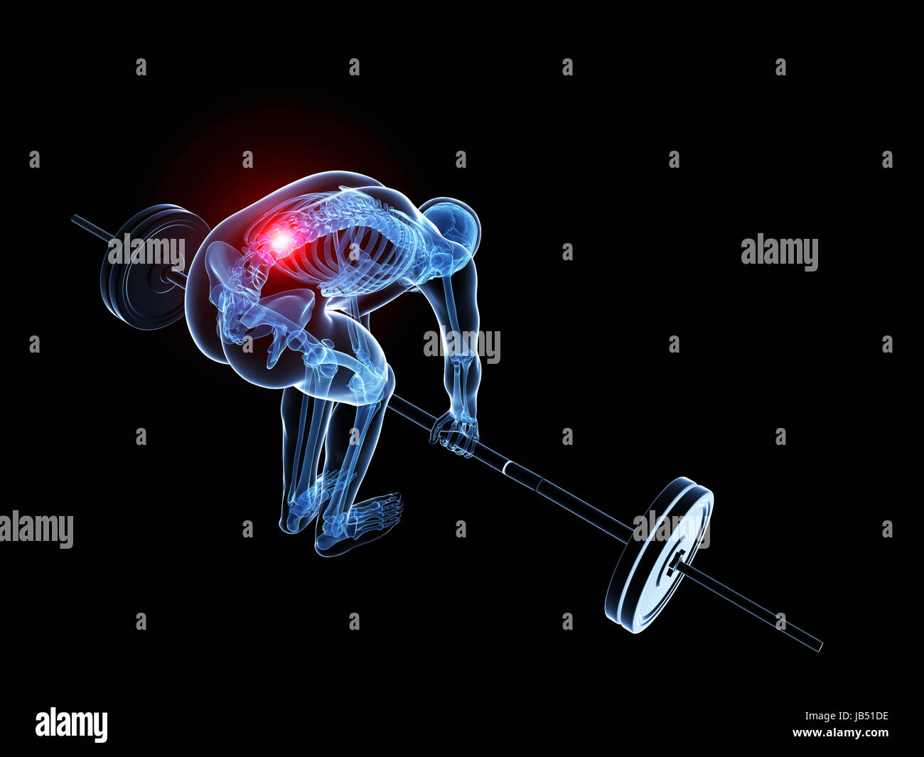 3d rendered medical illustration - wrong lifting posture Stock Photo ...