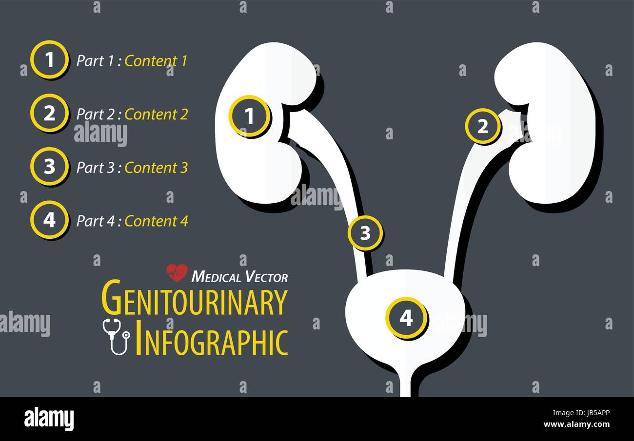 Genitourinary Infographic . Flat design Stock Vector Image & Art - Alamy