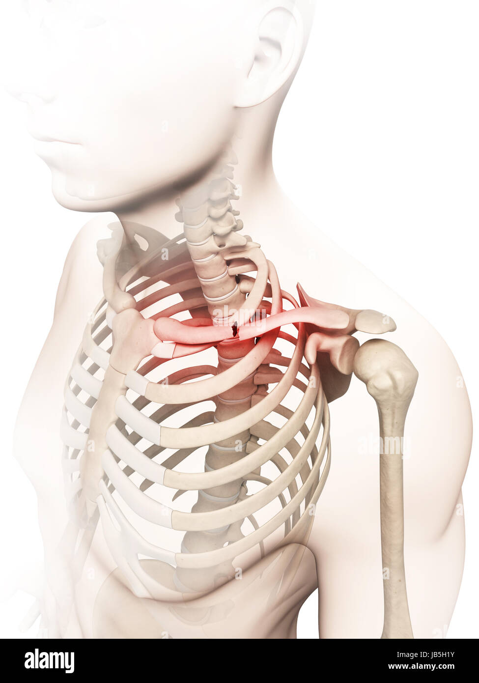 Broken clavicle hi-res stock photography and images - Alamy