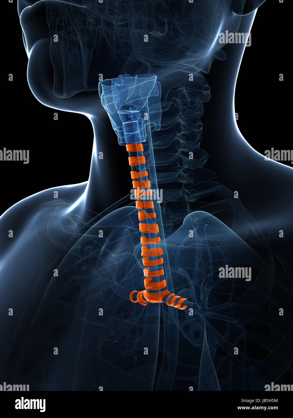 Cartilage Of Respiratory Tract