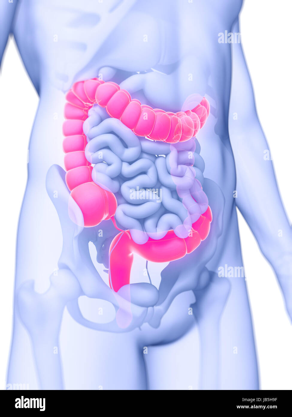 Inflamed large intestine hi-res stock photography and images - Alamy