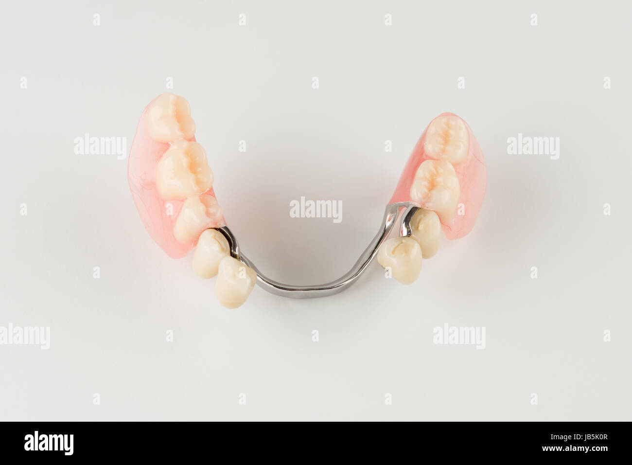 Clasp prosthesis with lock fixation on a white background Stock Photo ...
