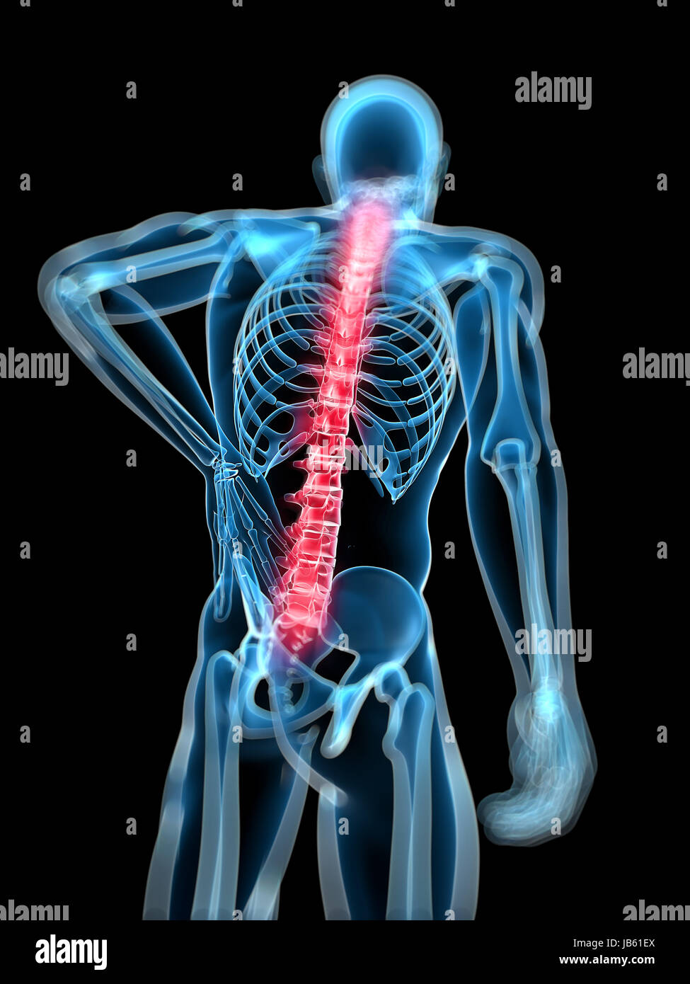 Posture spine xray hi-res stock photography and images - Alamy