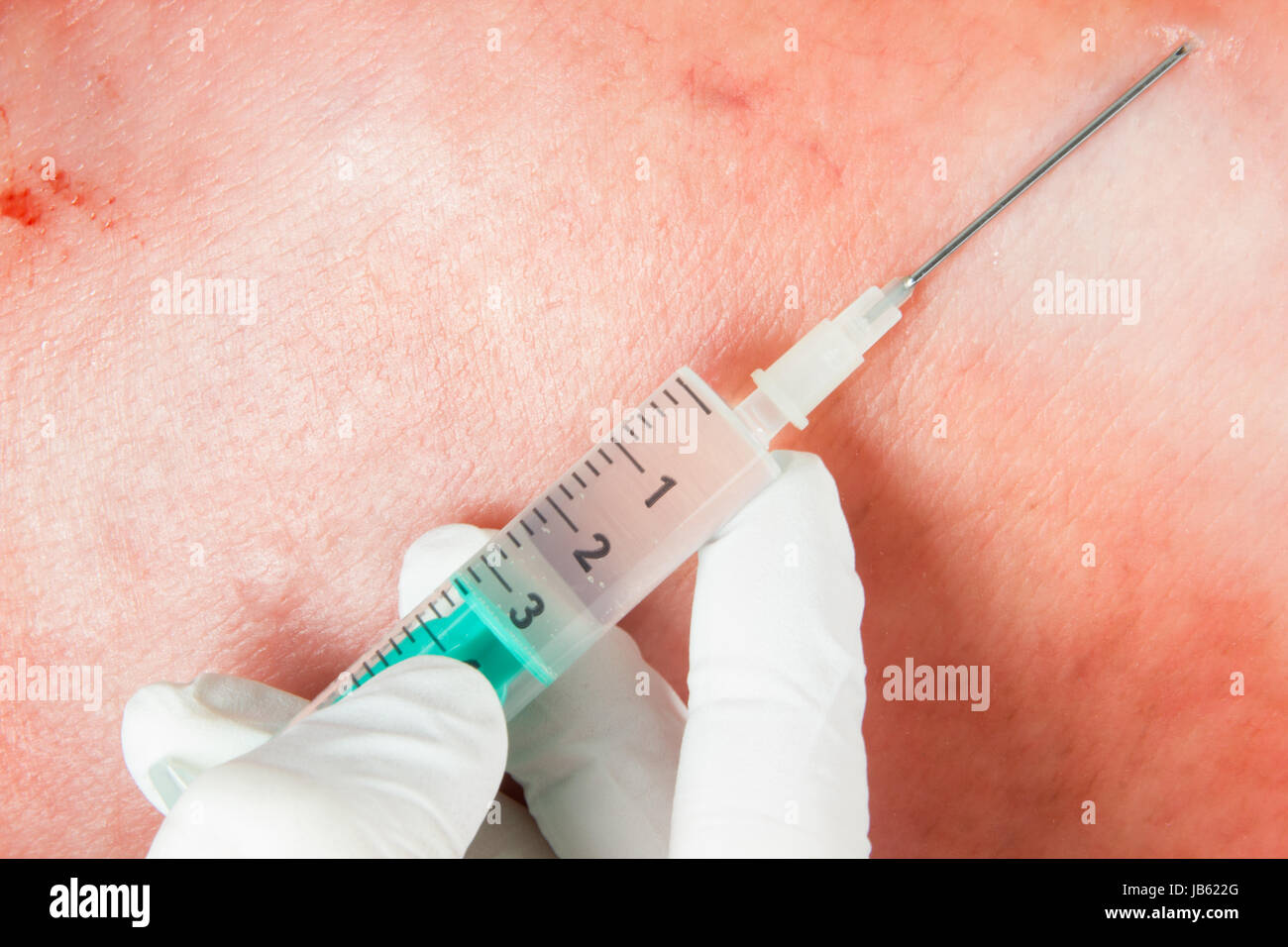 injection with a needle Stock Photo - Alamy