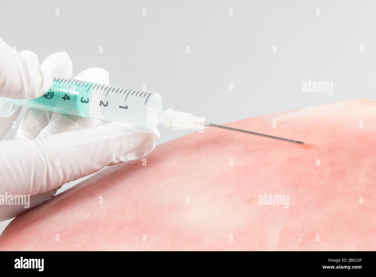 Medizinisches gerat hi-res stock photography and images - Alamy