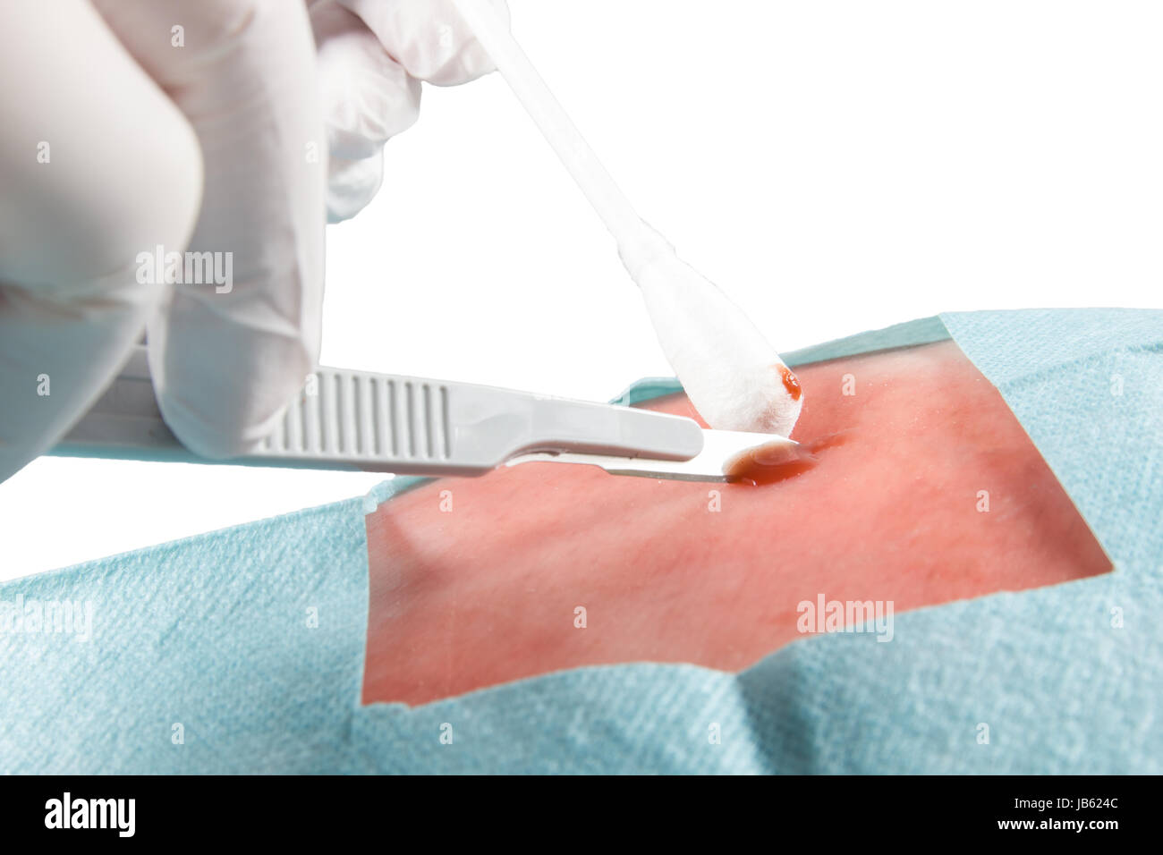 Surgeon operation cut hi-res stock photography and images - Alamy