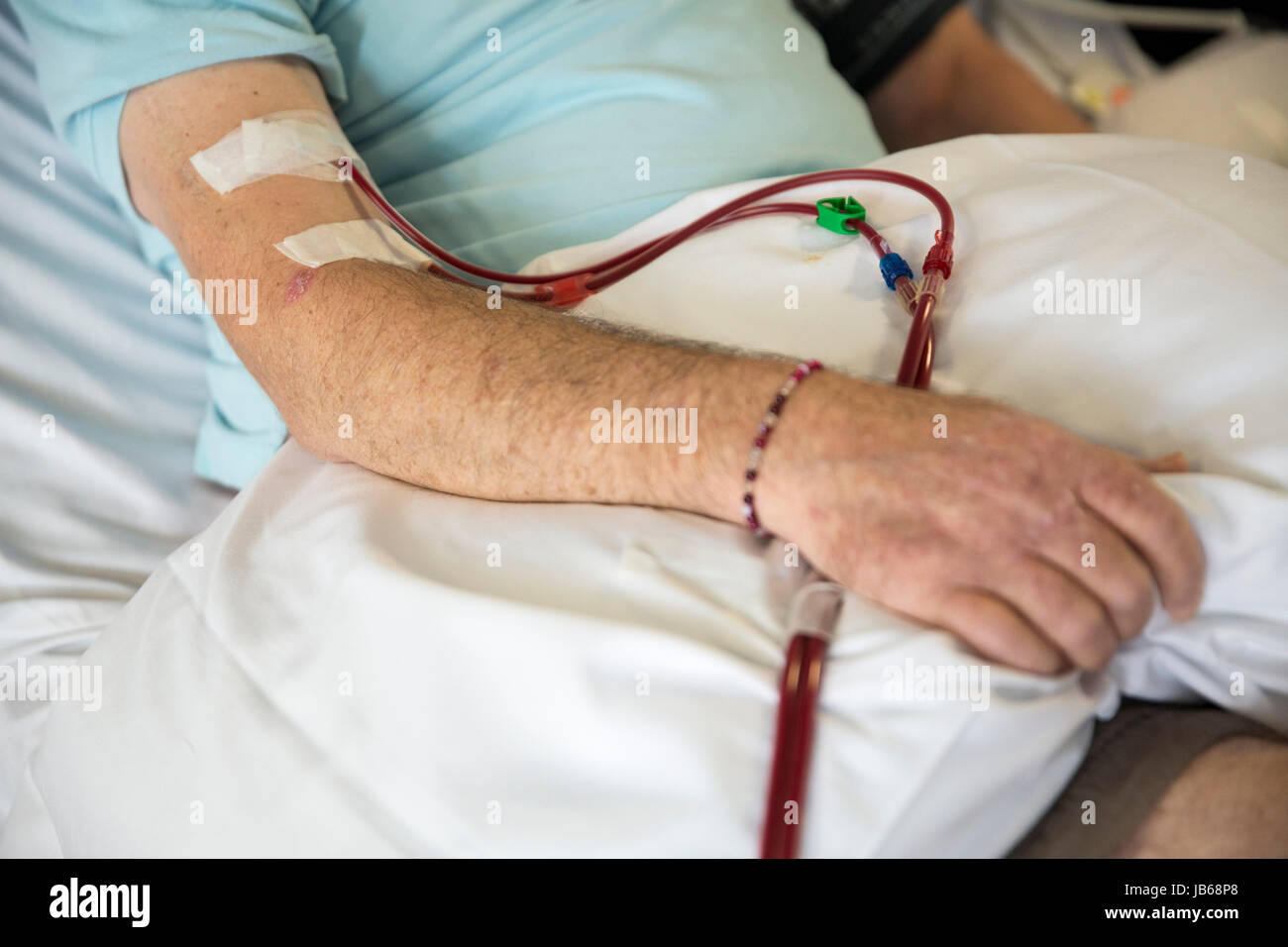 patient receiving kidney dialysis in hospital Stock Photo - Alamy
