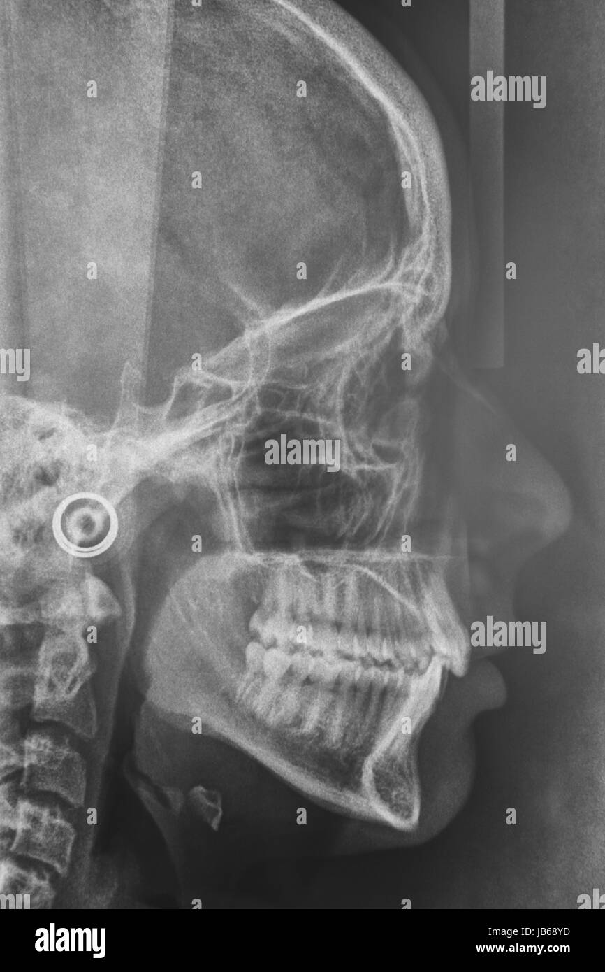 Cranio mandibular hi-res stock photography and images - Alamy