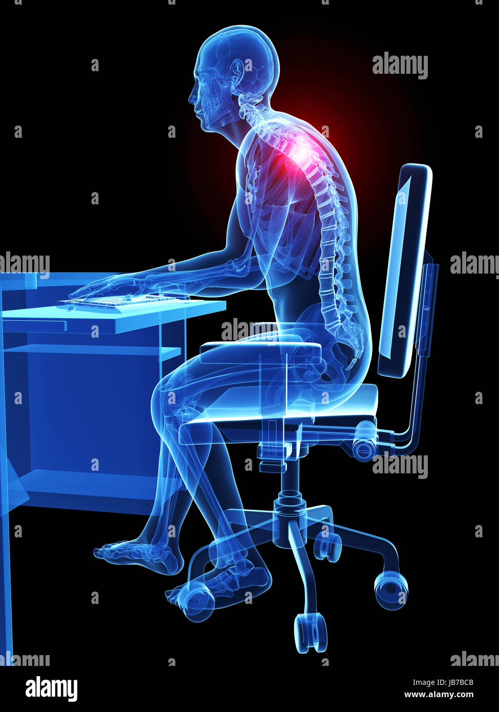 3d rendered medical illustration - wrong sitting posture Stock Photo ...