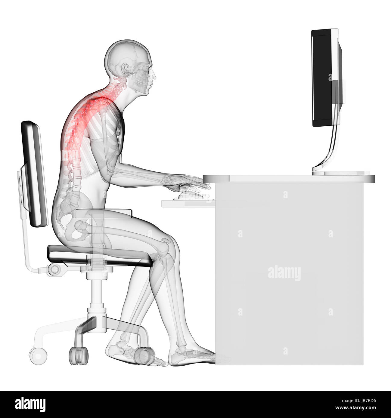 Wrong Sitting Posture High Resolution Stock Photography and Images - Alamy