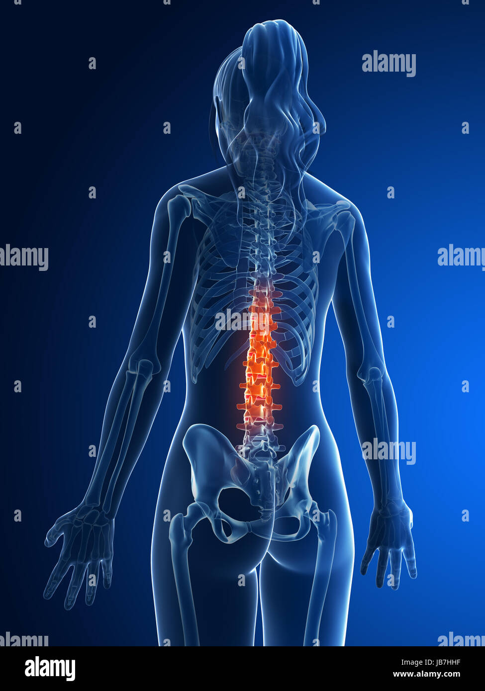 3d rendered medical illustration - backache Stock Photo - Alamy