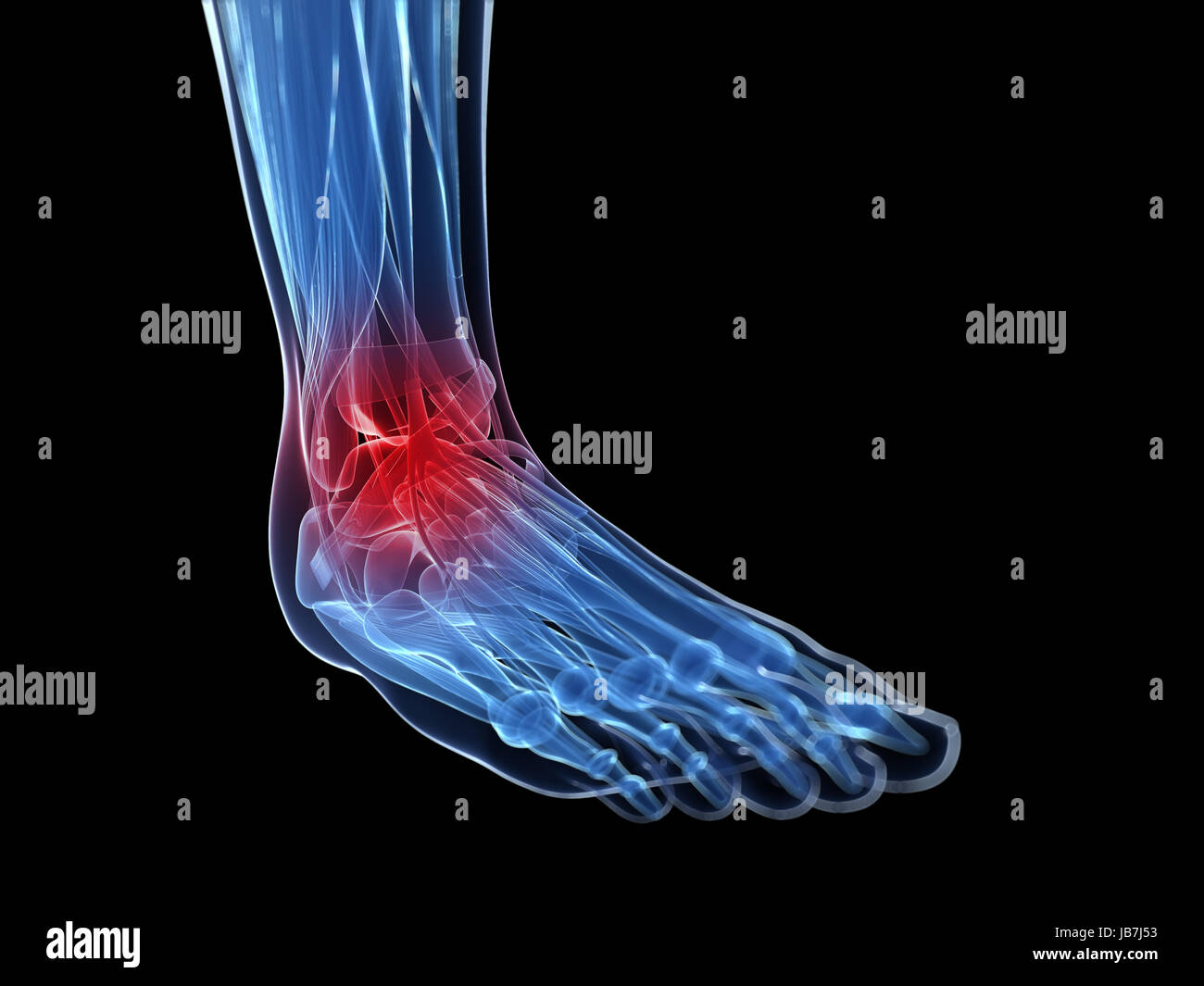 Arthralgia hi-res stock photography and images - Alamy