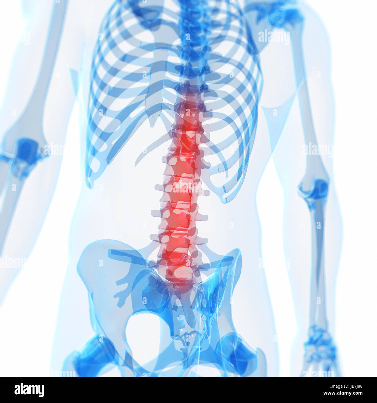 3d rendered illustration of a painful back Stock Photo - Alamy