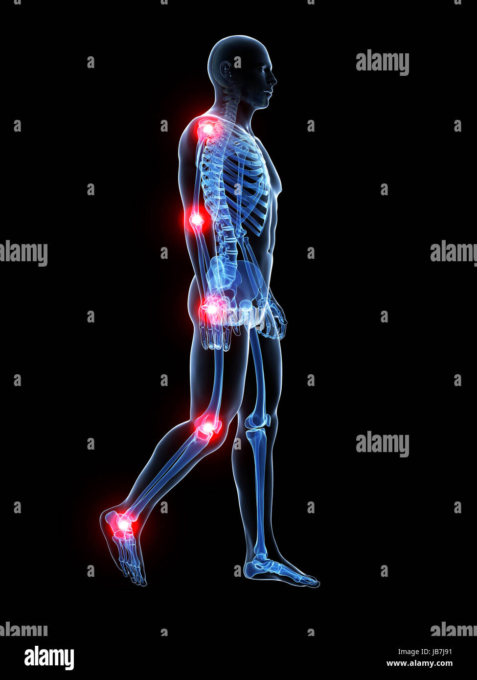 3d rendered medical illustration - painful joints Stock Photo - Alamy