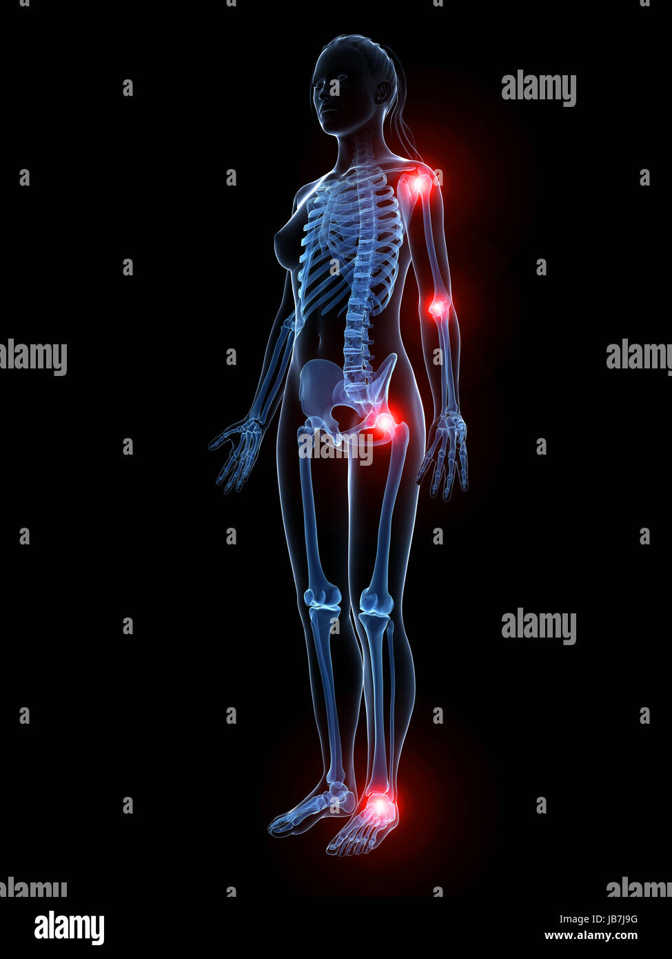Arthralgia Stock Photos & Arthralgia Stock Images - Alamy
