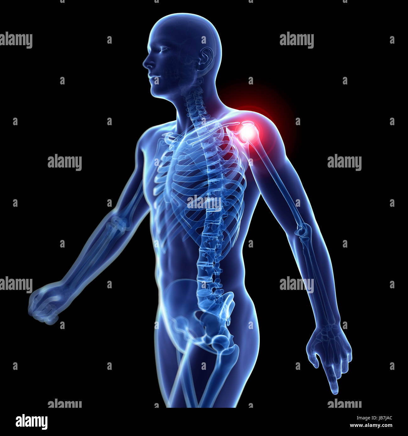 Illustration shoulder pain artwork hi-res stock photography and images ...