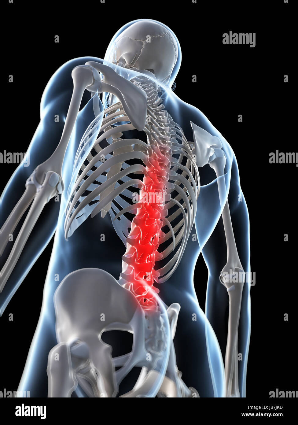 3d rendered illustration of a painful back Stock Photo - Alamy