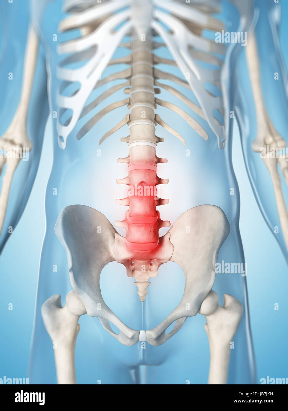 3d rendered illustration of a painful lumbar spine Stock Photo - Alamy