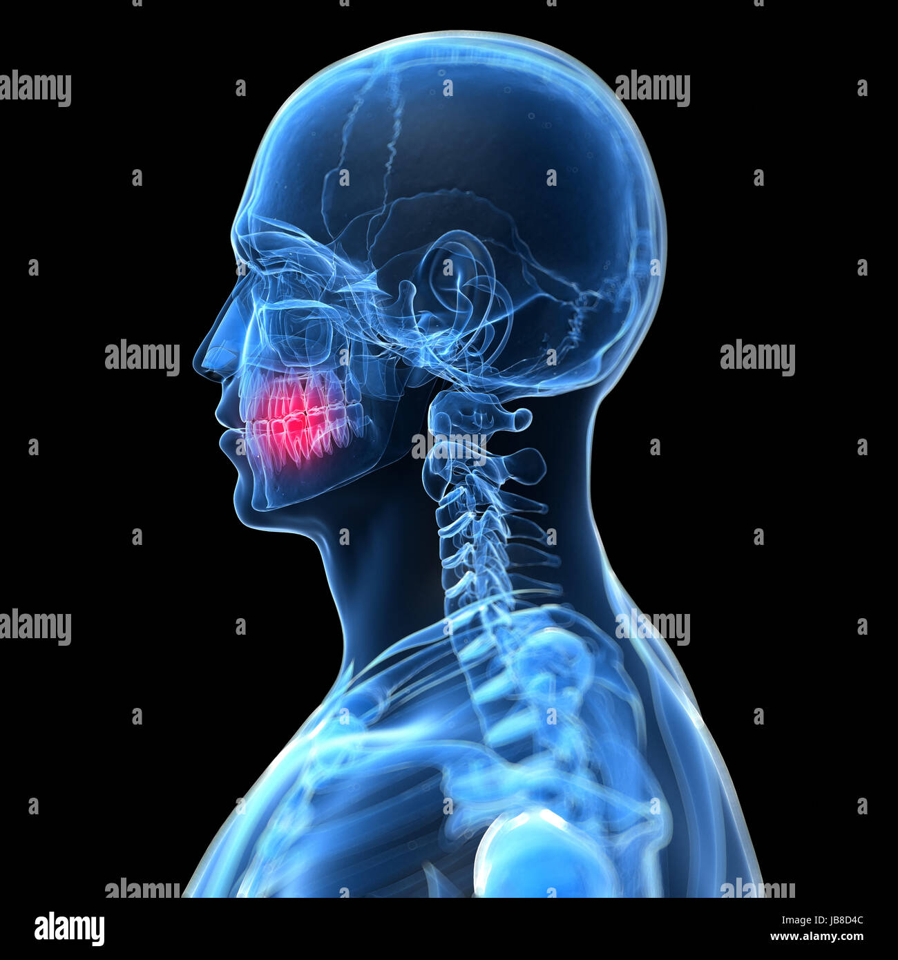 3d rendered illustration of painful teeth Stock Photo - Alamy