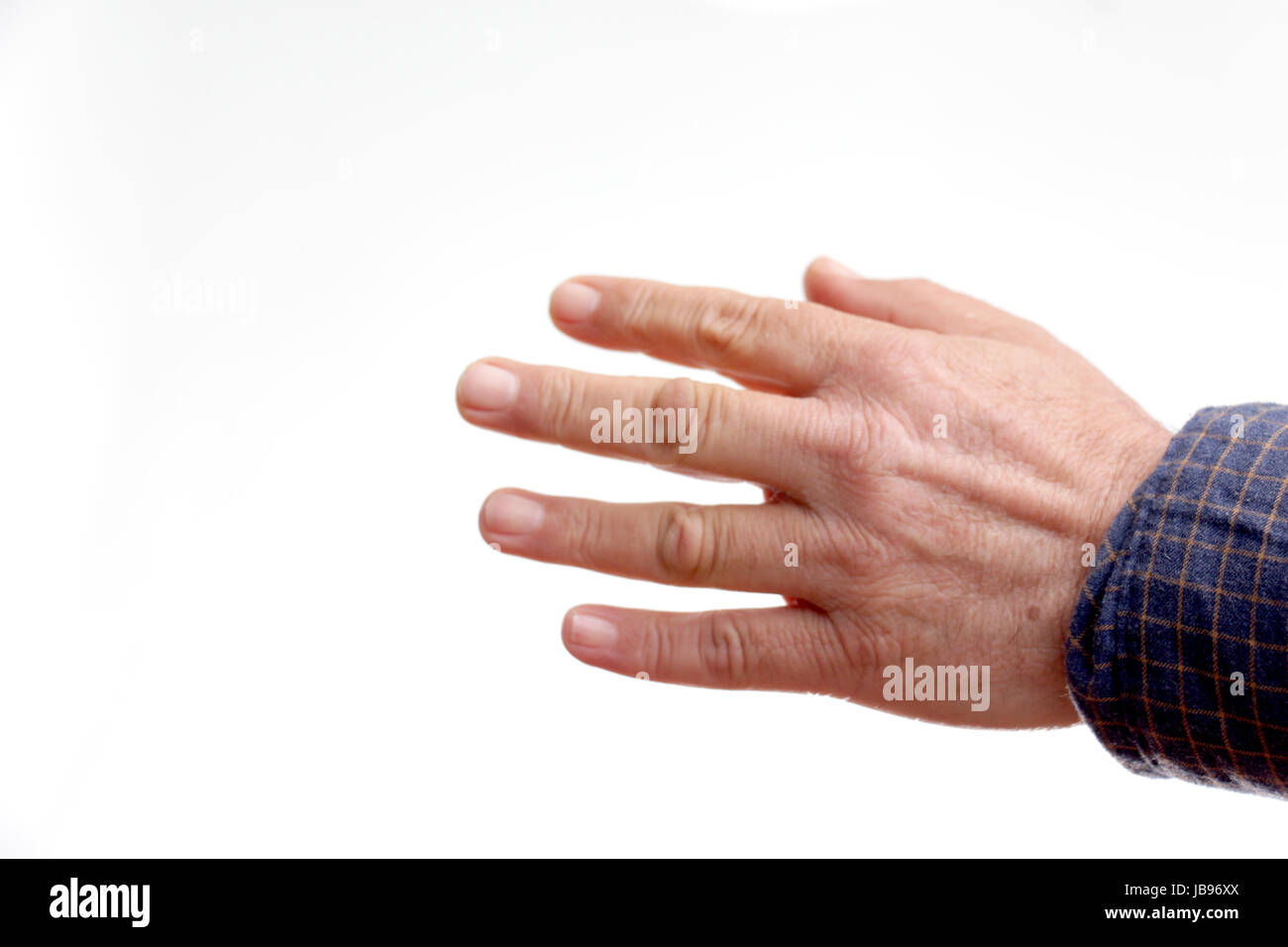 Bouchards nodes hi-res stock photography and images - Alamy