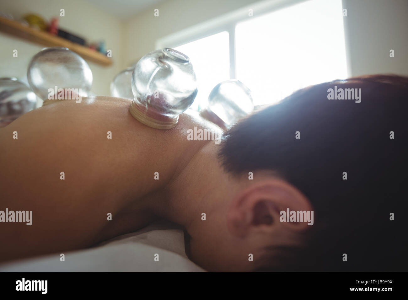 Close-up of man receiving cupping therapy in spa Stock Photo - Alamy