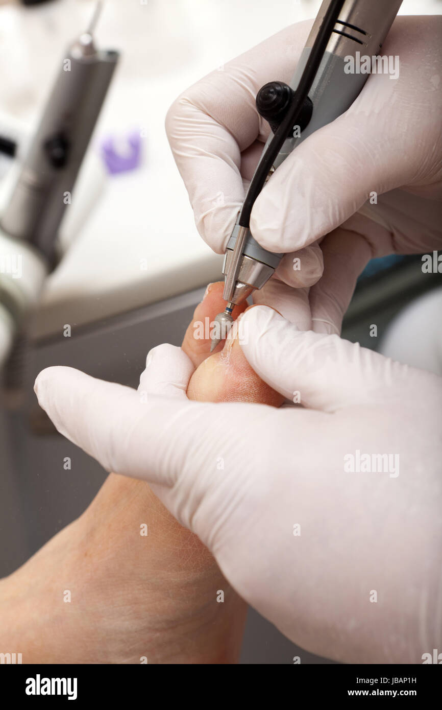 Zehennagel hi-res stock photography and images - Alamy