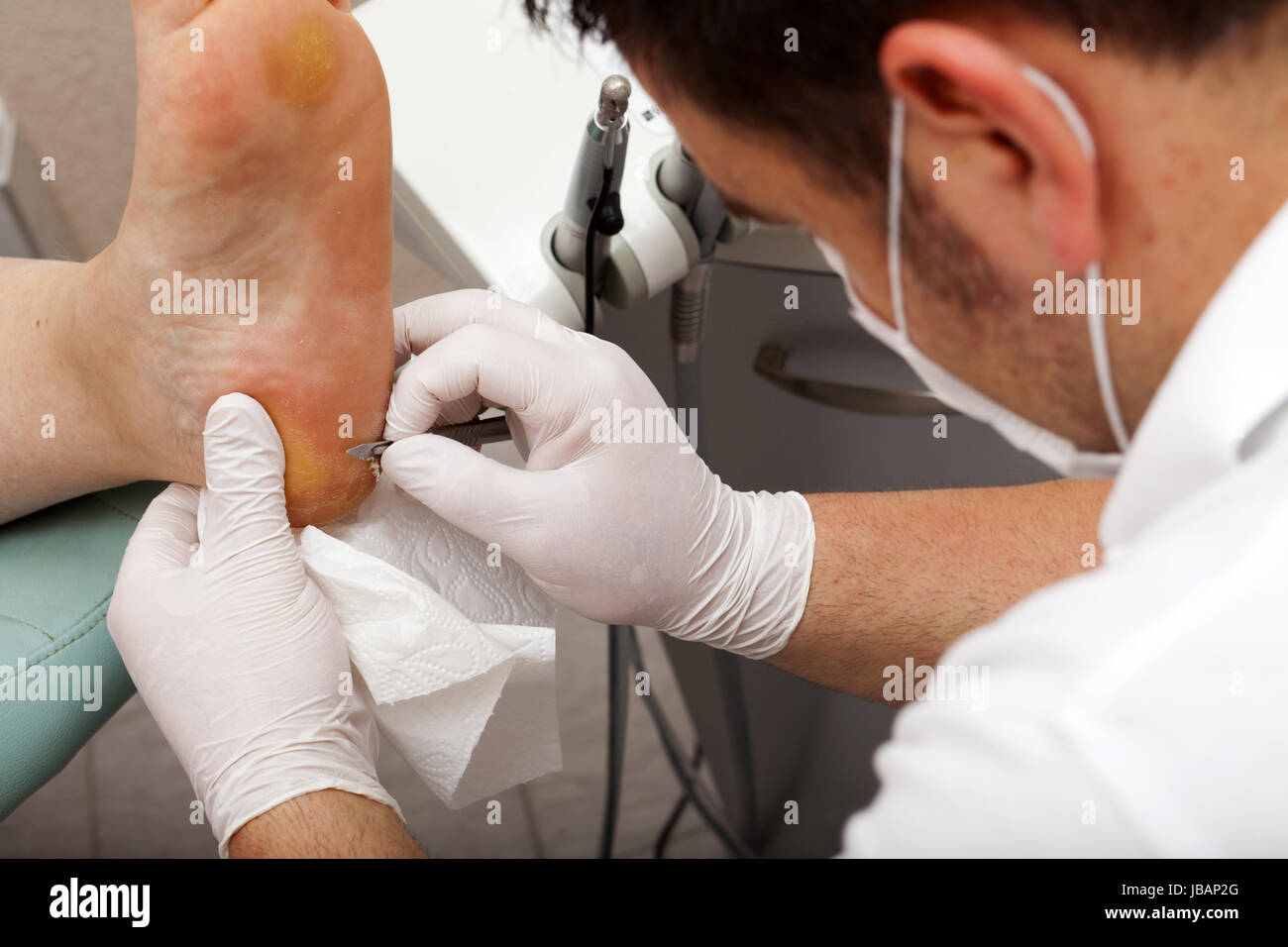 Fußpfleger entfernt Hornhaut an der Fußsohle Stock Photo - Alamy
