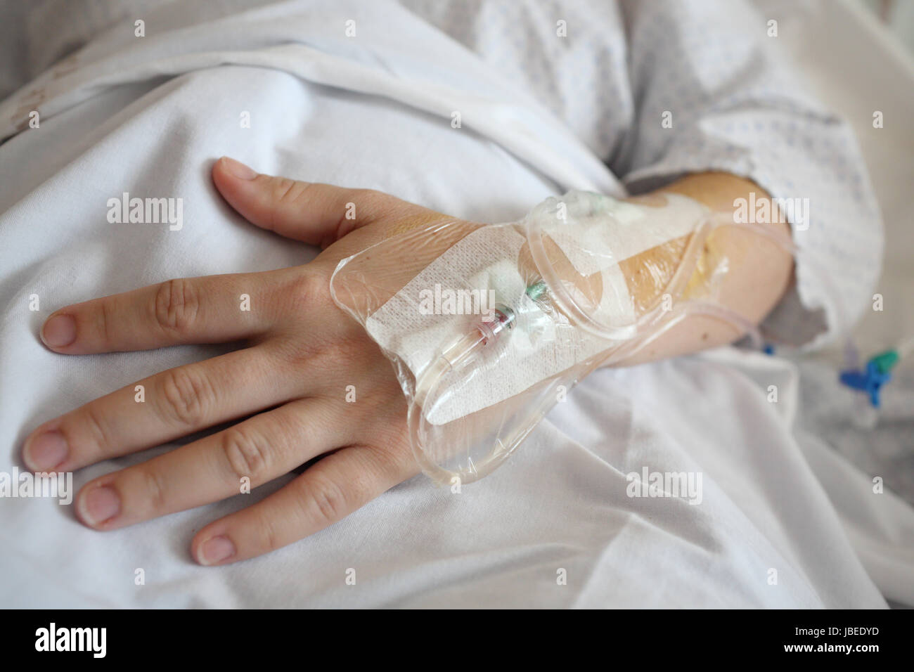 Details of an intravenous therapy with catheter Stock Photo - Alamy
