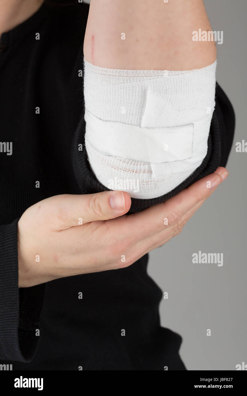 a close up on a bandaged ellbow of a woman Stock Photo - Alamy