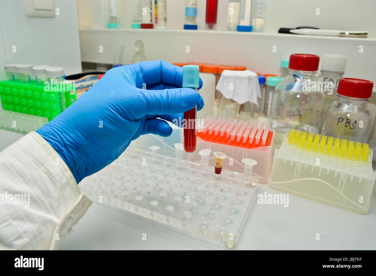 Blood lab study hi-res stock photography and images - Alamy