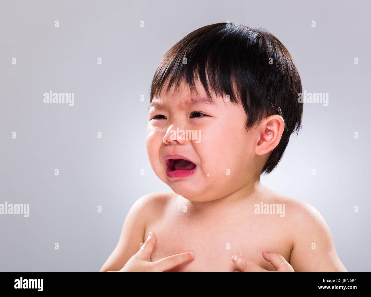Little boy has skin problem Stock Photo - Alamy