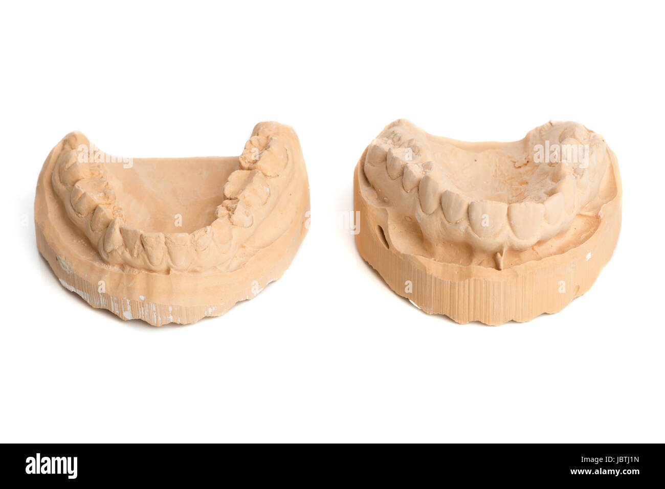 Dental Impression High Resolution Stock Photography and Images - Alamy