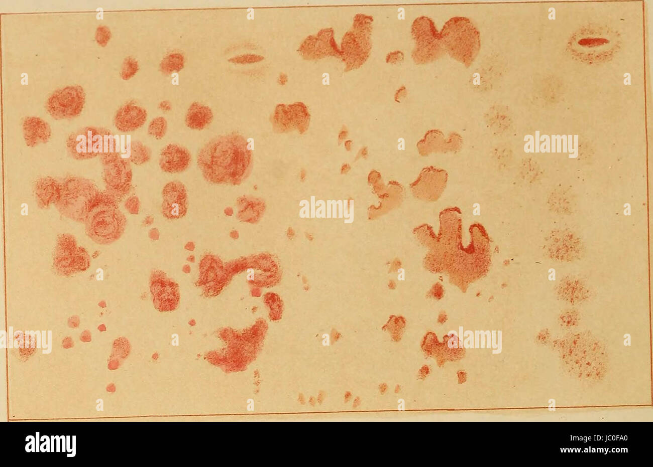 Venereal Diseases High Resolution Stock Photography and Images - Alamy