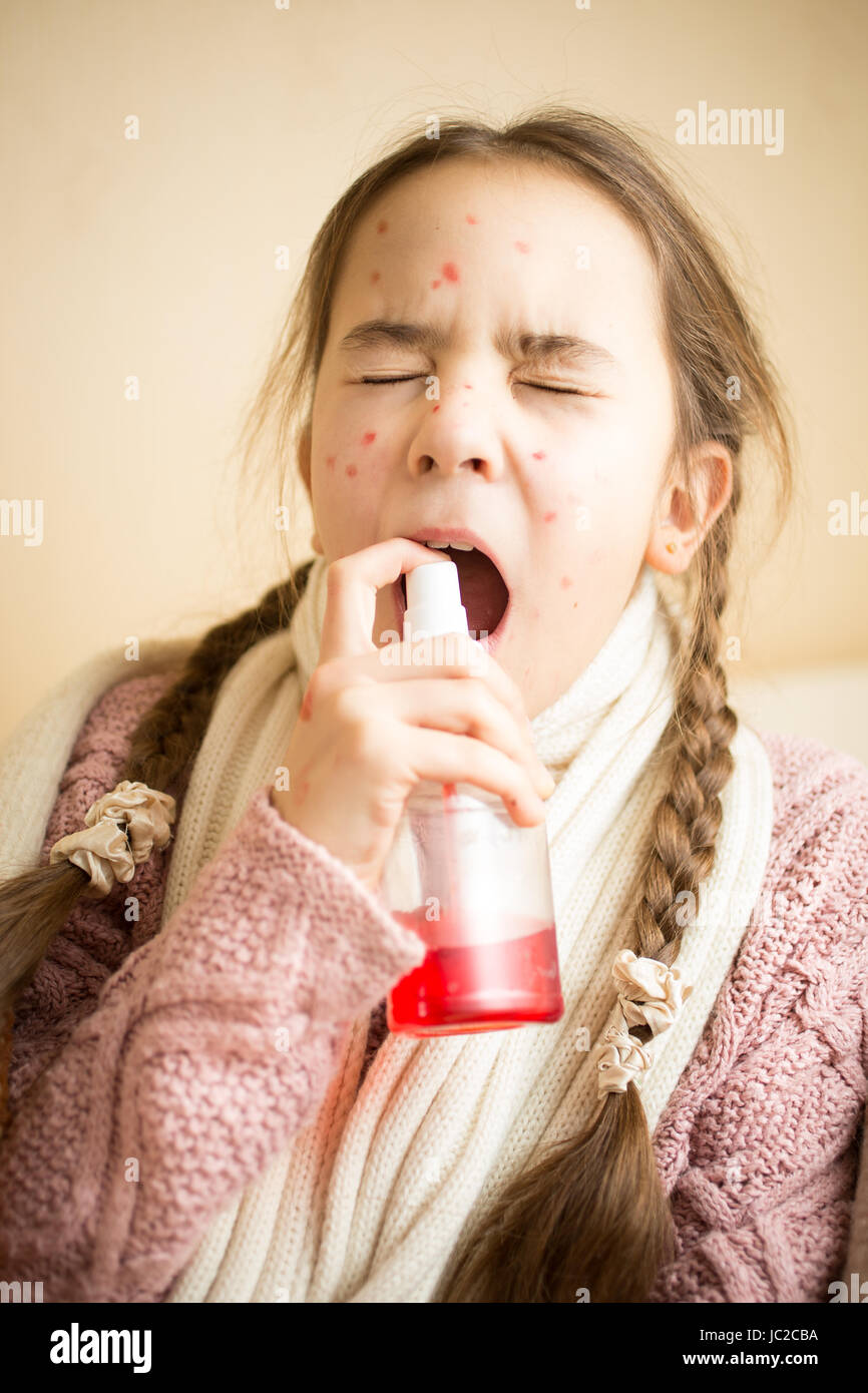 Portrait of young girl with flu using throat spray Stock Photo - Alamy