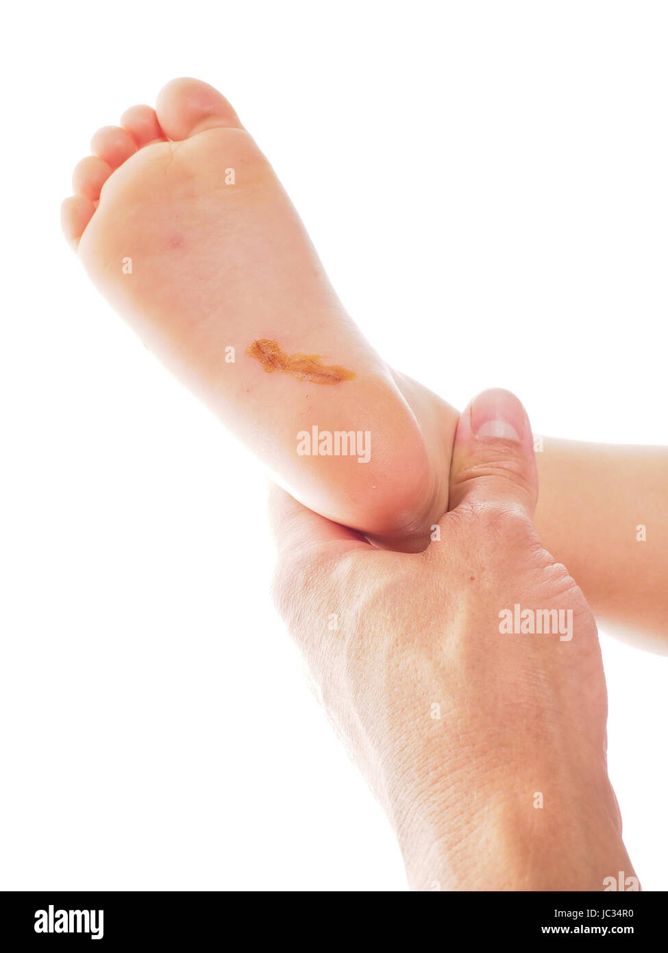 Child scratching leg hi-res stock photography and images - Alamy
